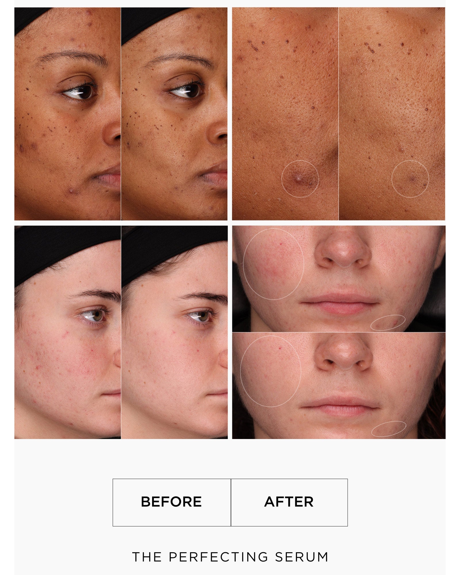 Transformative Oil Control Serum with Oil Control Complex 3™ | Radiant ...